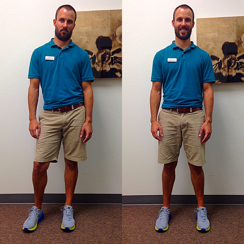 Stop “Hanging Out” on Your Joints - Therapydia Kona