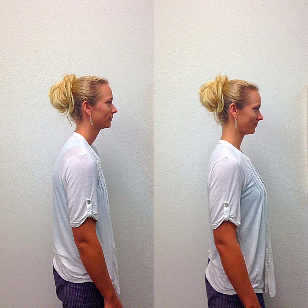 Stop “Hanging Out” on Your Joints - Therapydia Kona